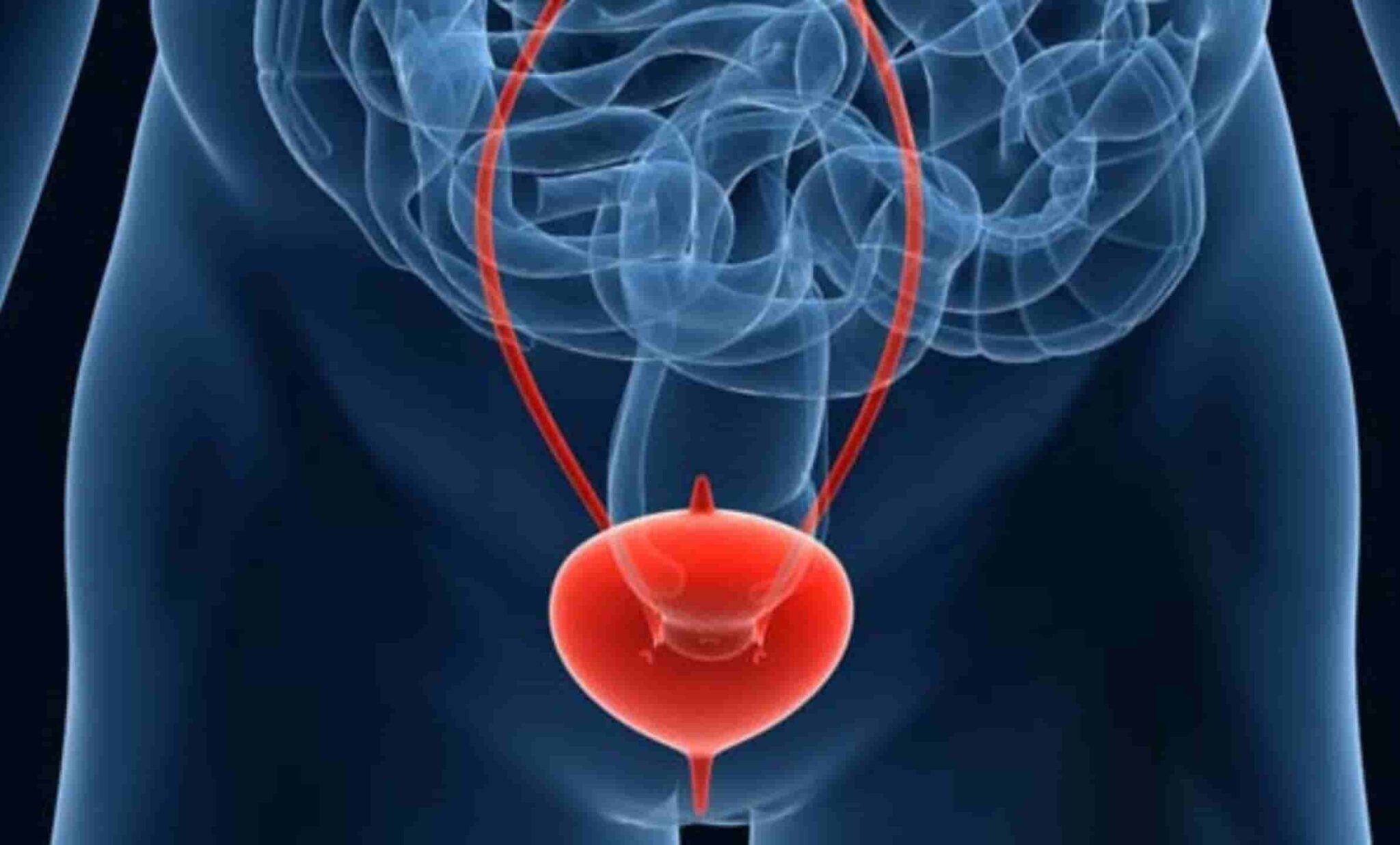 Medical Marijuana and Interstitial Cystitis - Rethink-Rx